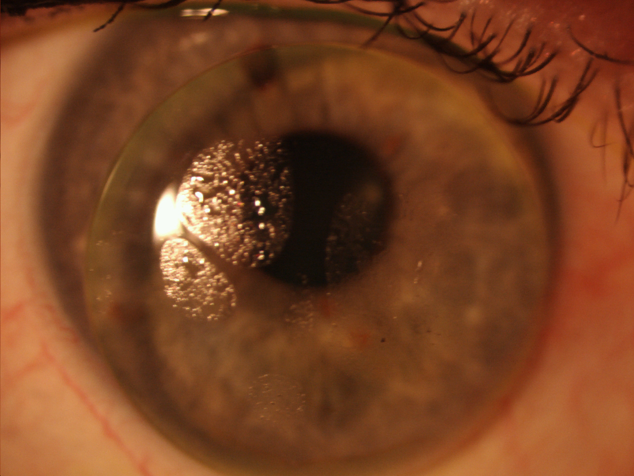 Comment paramétrer ses lentilles de contact